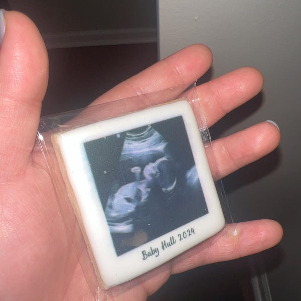 Baby Shower Cookies, Ultrasound Cookies, Edible Photo Cookies ...