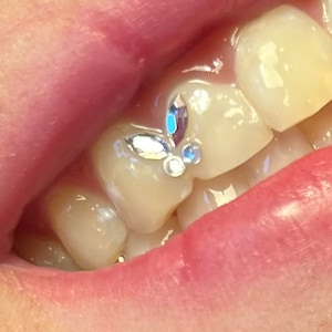 Gold 18K Tooth Gem - Etsy