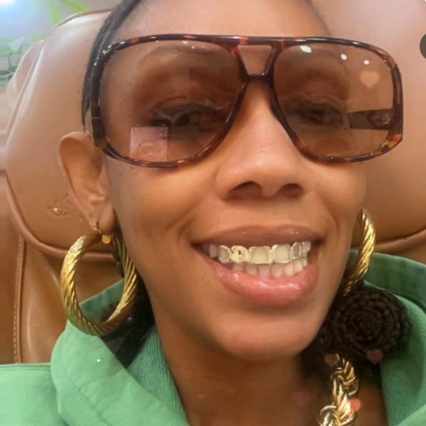 Sterling Silver Grillz 925 Custom Silver Teeth Real Open Face Silver ...