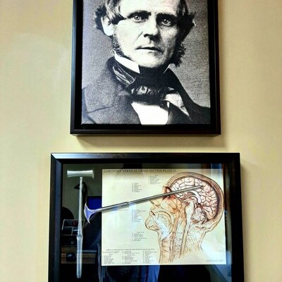 Lobotomy Shadowbox - Etsy