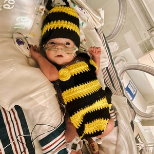 NICU Little Frog Micro Preemie Outfit With Overalls, Fits 2, 3, or 4 ...