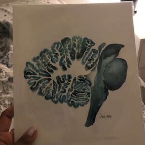 Blue Spine Print Series of 3 Anatomy Art Set 3 Watercolor | Etsy