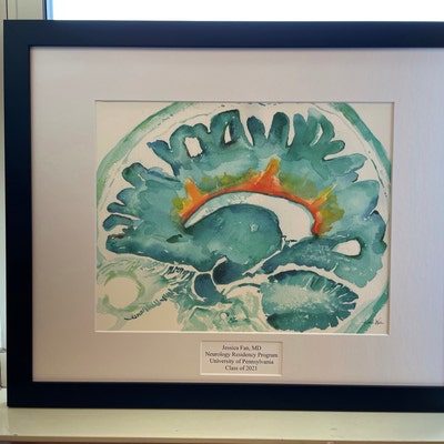 Dawsons Fingers Watercolor Print MS Art Multiple Sclerosis Painting ...