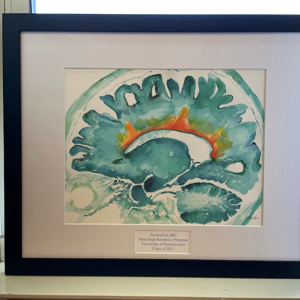 Dawson’s Fingers Watercolor Print - MS Art - Multiple Sclerosis ...