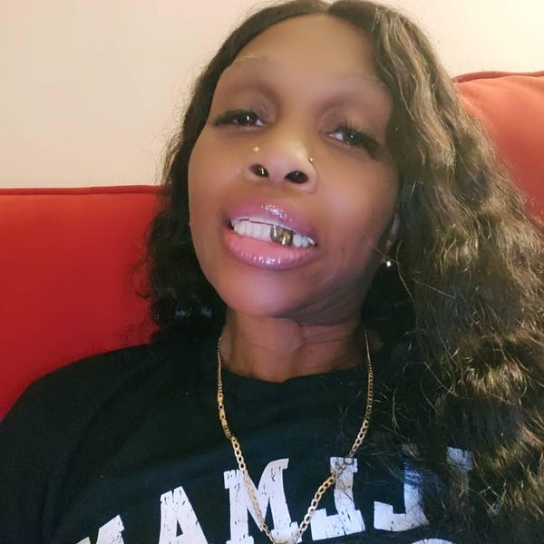 Handmade CUSTOM Gold Grillz Solid NPG Dental Gold Substitute Perm Cut ...