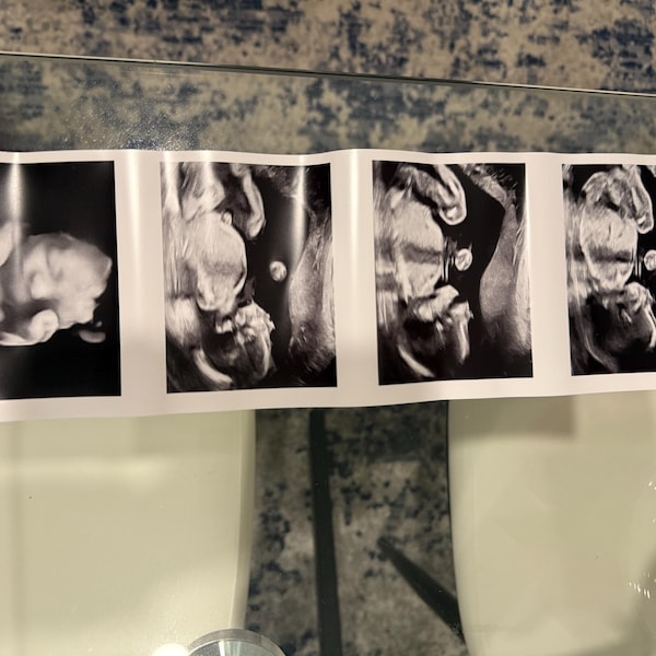 Traditional Ultrasound Strip - Upload Your Digital Images - Etsy