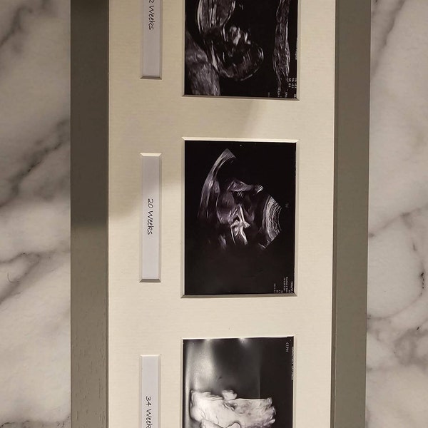 Baby Scan Photo Frame - Multi Aperture Frame for Three Scan Sized ...