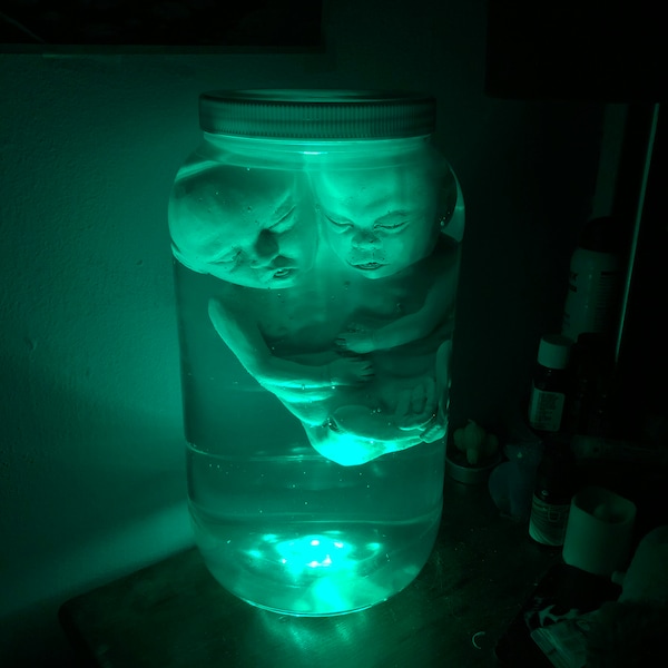 Formaldehyde Skin Siamese Twin Fetus Baby Fetal Specimen - Etsy