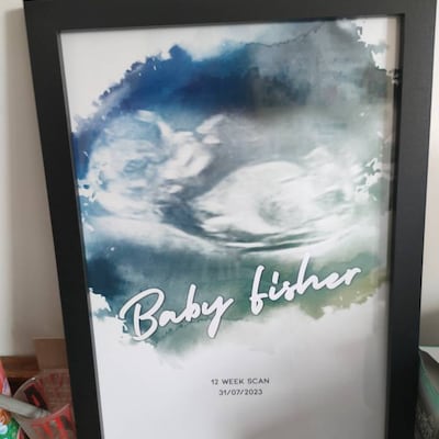 Personalised BABY Scan Ultrasound Watercolour Print 4D First Baby Scan ...