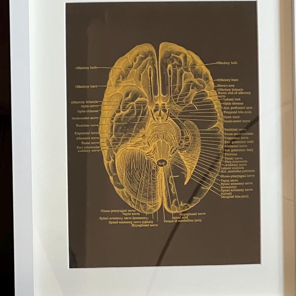 Brain Anatomy Print - Neuroscience Gift - Neurosurgeon Gift - Gold Foil ...