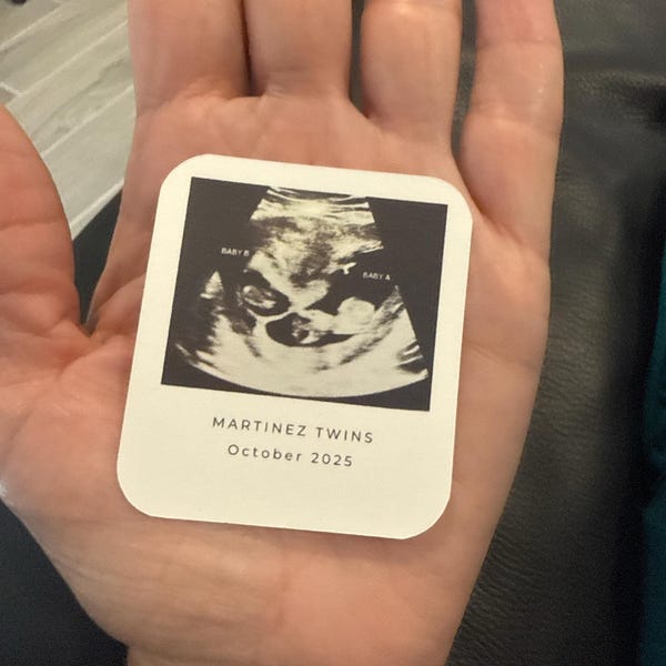 Baby Shower Decorations | Ultrasound Confetti | Custom Decorations Baby ...