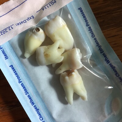 10 Real Human Teeth molars, Premolars, & Anteriors - Etsy