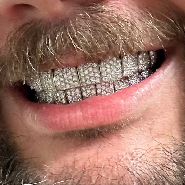 Custom Grillz With Extended K9s and Back Bar - Etsy