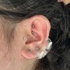 Keloid Compression-'bean' - Etsy
