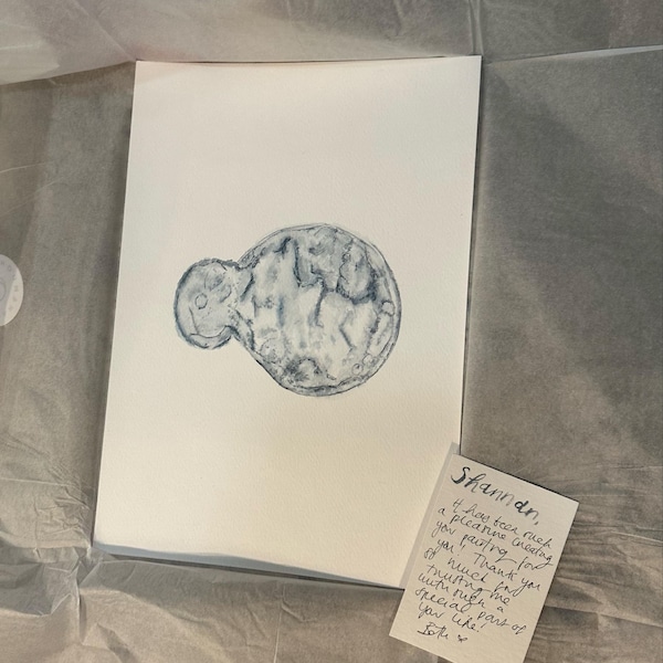 Embryo Art | Ivf Painting | Embaby Art | Hand-painted Nursery Decor ...