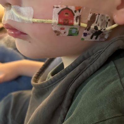 Ng Tube, Nasogastric or Oxygen Tube Adhesive Tape Length Floral MIX ...