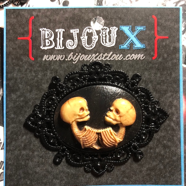 Conjoined Twins Skull Cameo Cabs: Gothic Siamese Skeletons (40x30mm ...