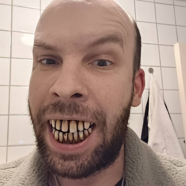 Siren Mermaid Custom Teeth - Etsy