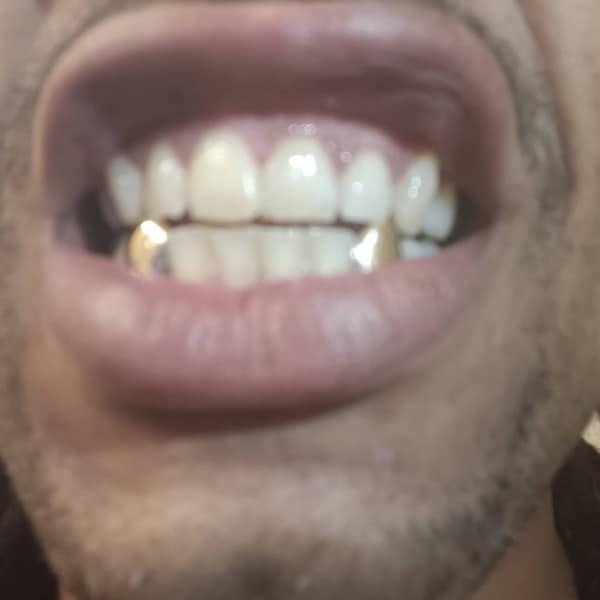 Custom Grillz With Extended K9s and Back Bar - Etsy