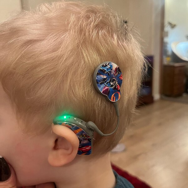 Cochlear Implant Skins Cochlear Implant Stickers - Etsy