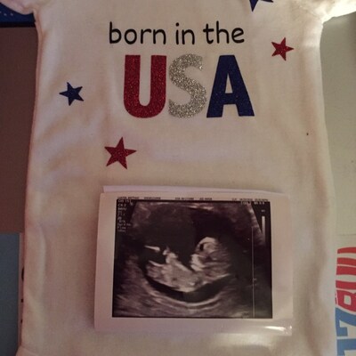 Acute Baby SVG Cut File Bundle - Etsy