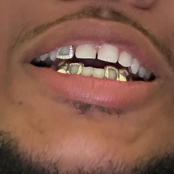 BLACK GRILLZ Hip Hop, Sadboi Style Custom Made Rapper Jewellery Grillz ...