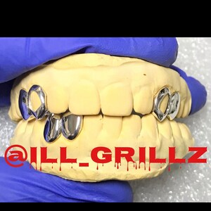 Handmade Custom Dental Gold Top Fangs With Bottom Wolf Style - Etsy