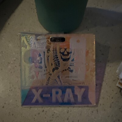 Radiology Badge Buddy Xray Badge Buddy Anatomy Badge Buddy Ortho Badge ...