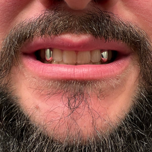 925 Sterling Silver Single Canine Teeth Grillz, Custom Fitted - Etsy