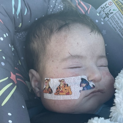 Ng Tube, Nasogastric or Oxygen Tube Adhesive Tape Length Floral MIX ...