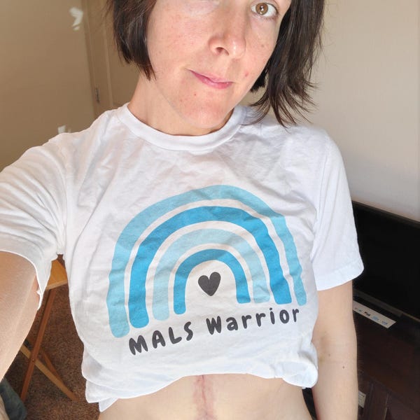 SMAS Warrior Shirt, Superior Mesenteric Artery Syndrome, SMAS Awareness ...