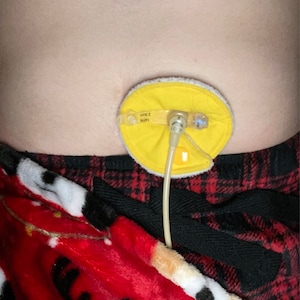 Solid Color Trach Pads Tracheostomy Pad Trach Dressing - Etsy