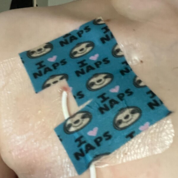 Extra Large Medical Port Cover, SPC Tube-suprapubic Catheter, GJ Tube ...