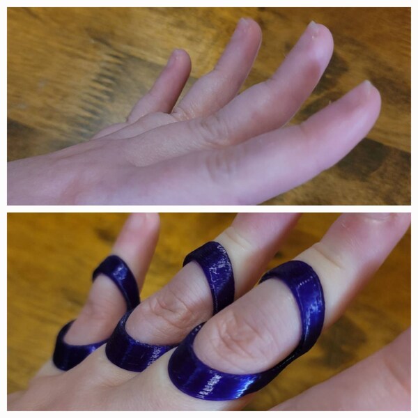 Finger Splint Ring SET OF 3 (graduated Set) • 3D Printed • EDS • Ehlers ...