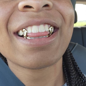 Handmade Custom Dental Gold Top Fangs With Bottom Wolf Style Grillz - Etsy