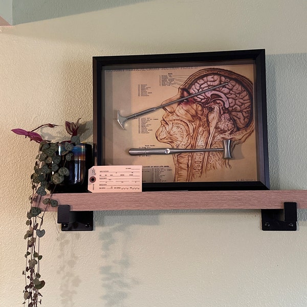 BESTSELLER! Lobotomy Shadowbox Display Large - Etsy