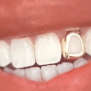 10K Gold Custom Grillz Two Front Teeth Real Solid Gold Double Cap Teeth ...
