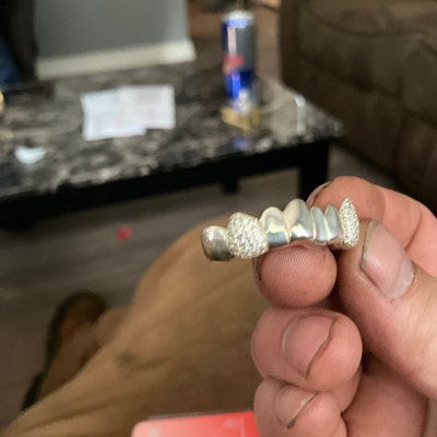 The BEST Mold Kits for Grillz Mold Impression Kit for Custom Grillz ...