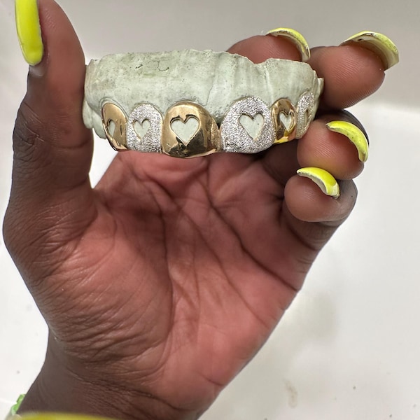 Custom Grillz With Extended K9s and Back Bar - Etsy