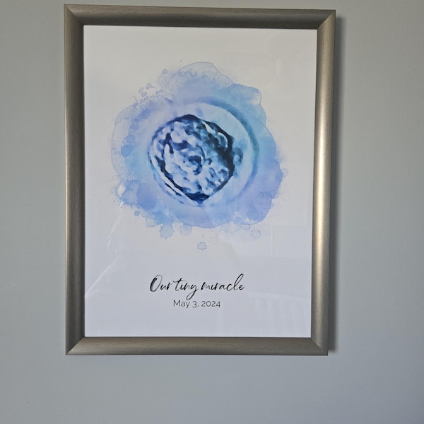 Custom IVF Art Embryo Watercolor Personalized Pregnancy Gift - Nursery ...