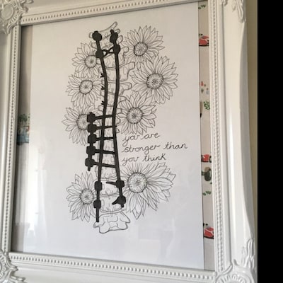 Custom Scoliosis / Spinal Fusion Digital Art Print PRINTABLE - Etsy UK
