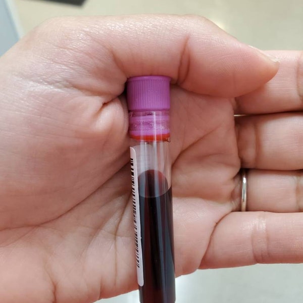 Blood Test Tube Keychain / Chemistry / Transfusion / Blood Bank ...