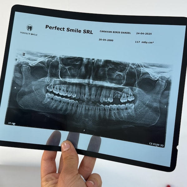 Transgender Girls Tucking Underwear Gaffs - Transgender Everyday ...