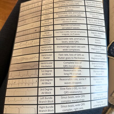 Veterinary ECG Tracings Chart Magnet,veterinary Cardiology Chart,vet ...