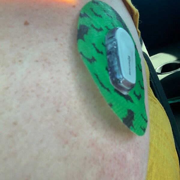 Custom Omnipod Overlay Patches - Etsy