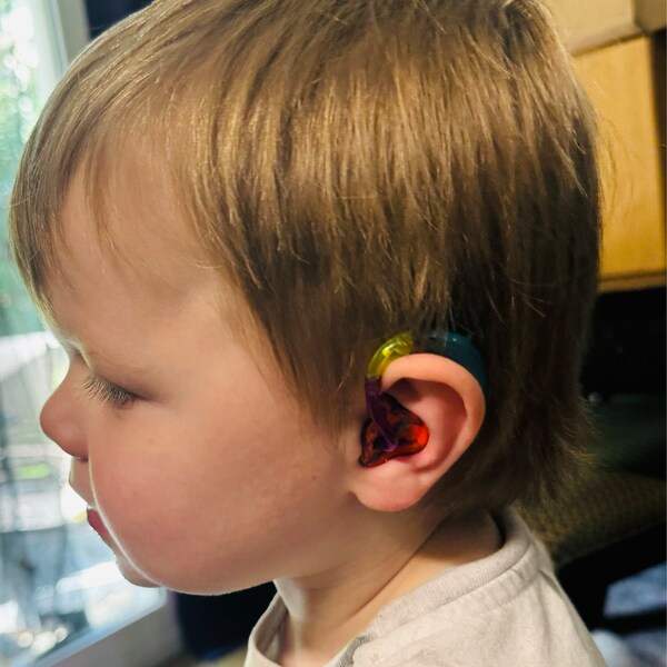 Cochlear Implant Accessories (cochlear Bling) or Hearing Aid Accessory ...