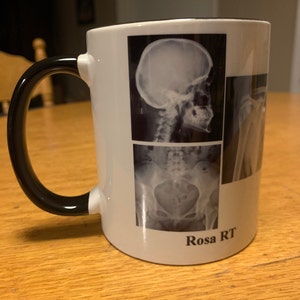 Joints Gift Anatomy Magnet Set Doctor Teacher Nurse Bones Arthritis Hip ...