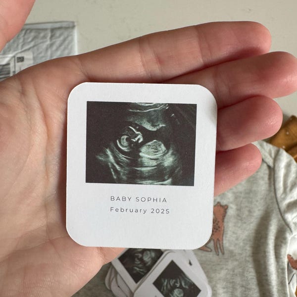 Baby Shower Decorations | Ultrasound Confetti | Custom Decorations Baby ...