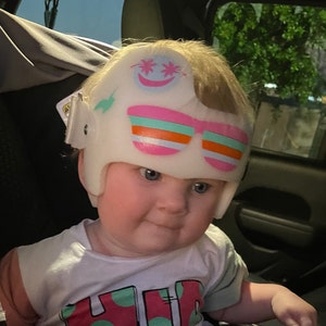 Baby Helmet Decals, Shark Cranial Band Doc Band Design for ...