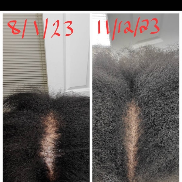 Cacao Pod Husk, Shampoo Infused With Saw Palmetto and Biotin - Etsy